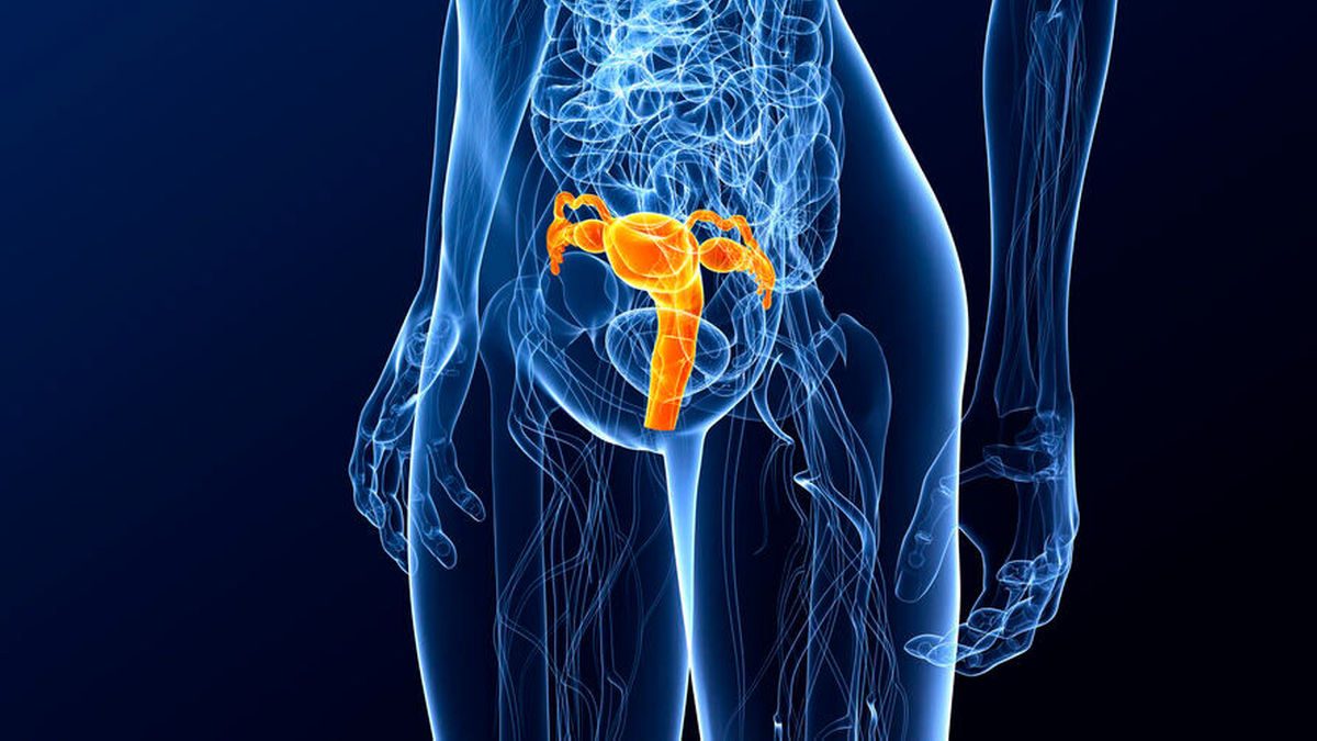 Gebärmutterhalskrebs (Zervixkarzinom)