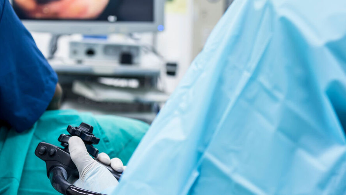 Koloskopie: KI zur optischen Diagnose von Darmpolypen