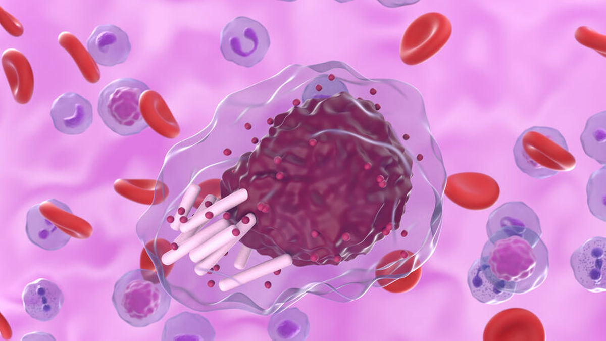 r/r CLL: PFS- und OS-Vorteil unter Venetoclax/Rituximab