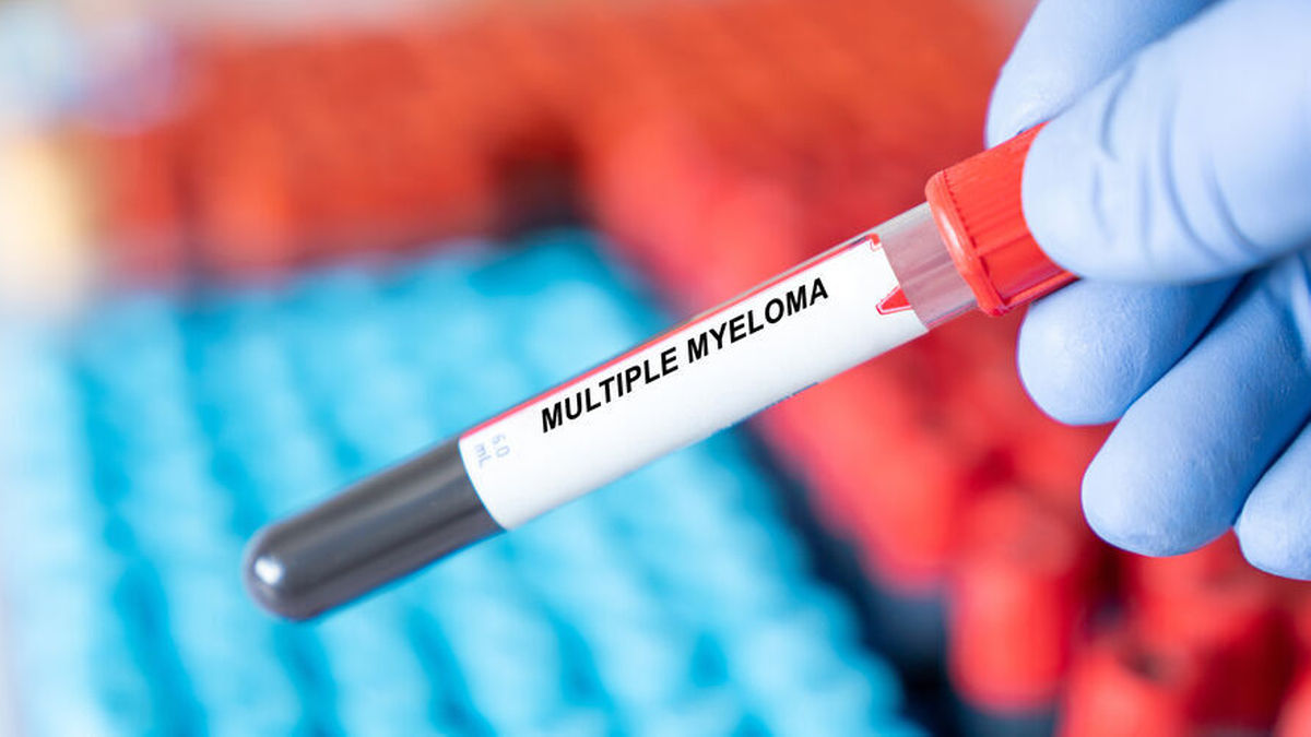 Multiples Myelom: Update zu Diagnostik und Therapie