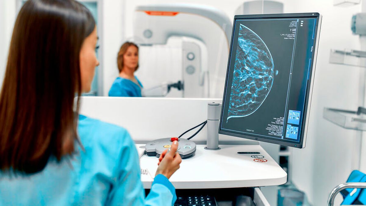 Ein Update zum Mammographie-Screening-Programm