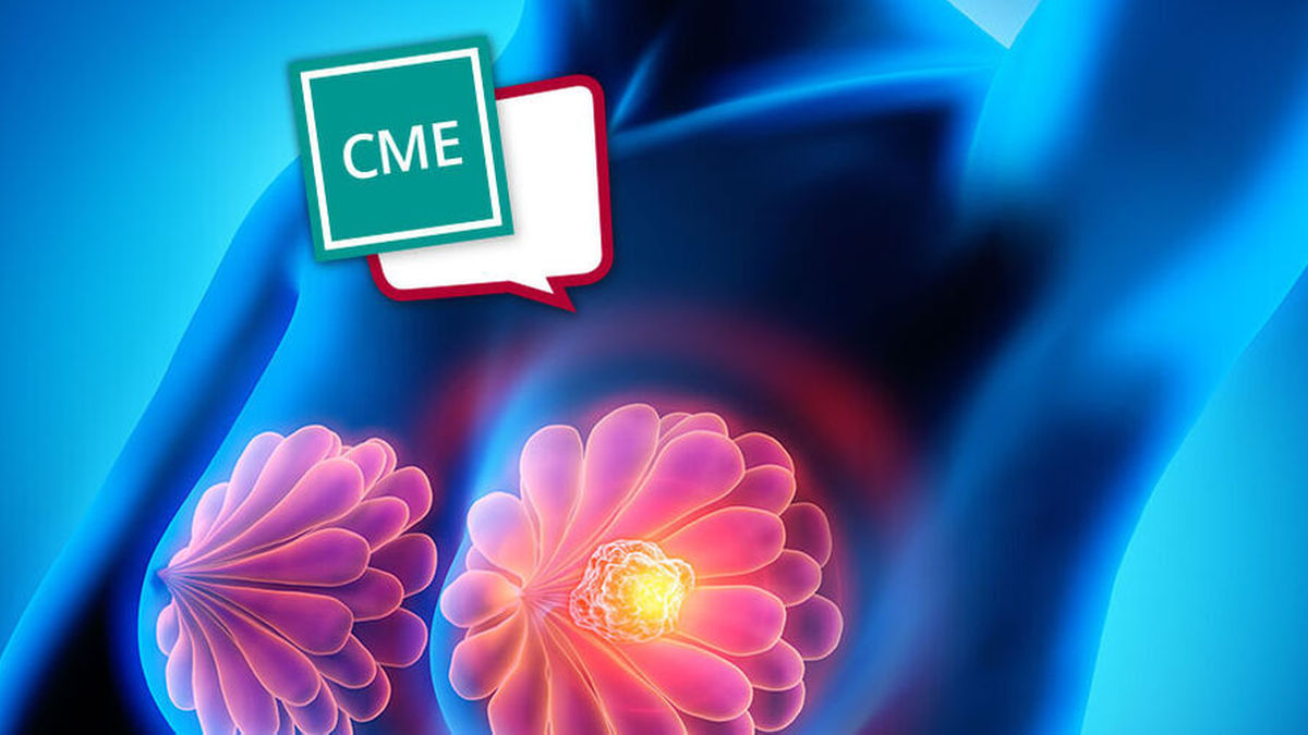 Wiederaufnahme: TNBC: Update – „the new kids on the block”