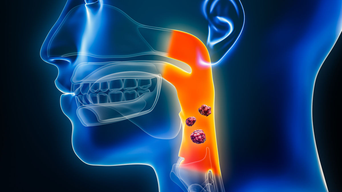 Cetuximab: Q2W-Verabreichung so sicher und wirksam wie Q1W
